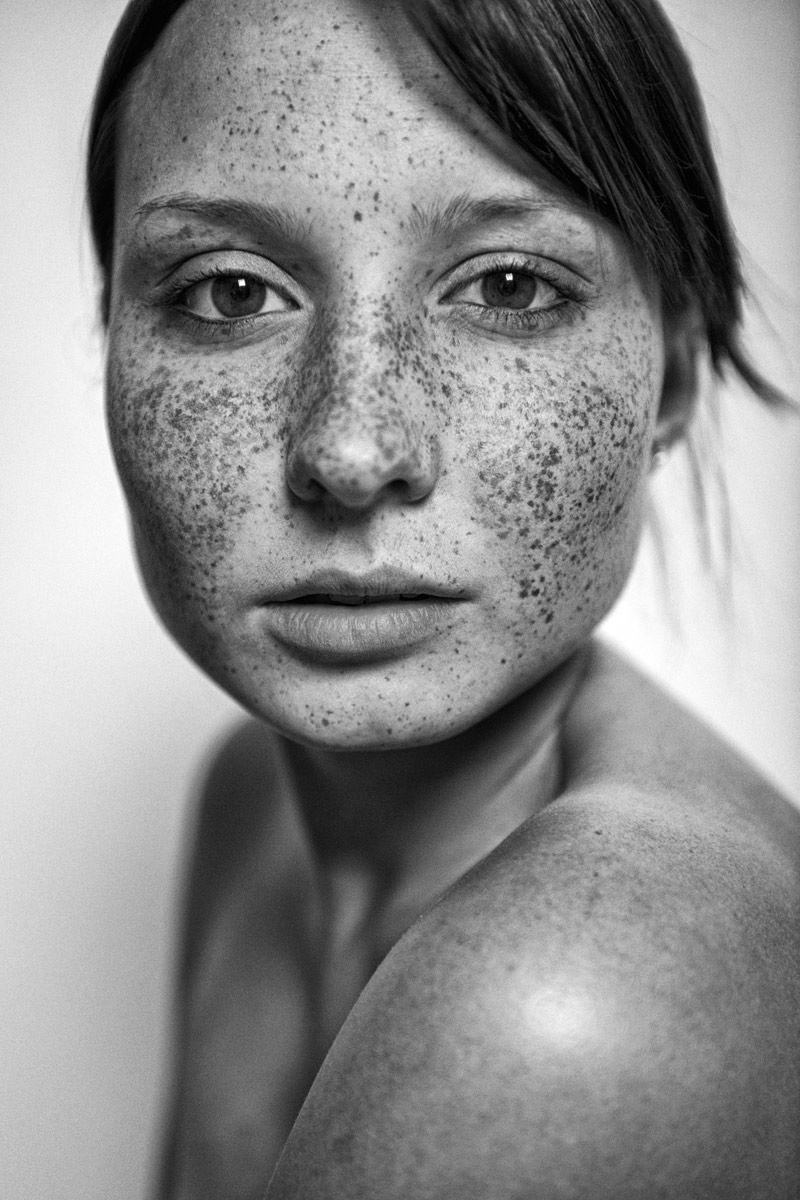 Freckles | Frank Schroth Fotografie